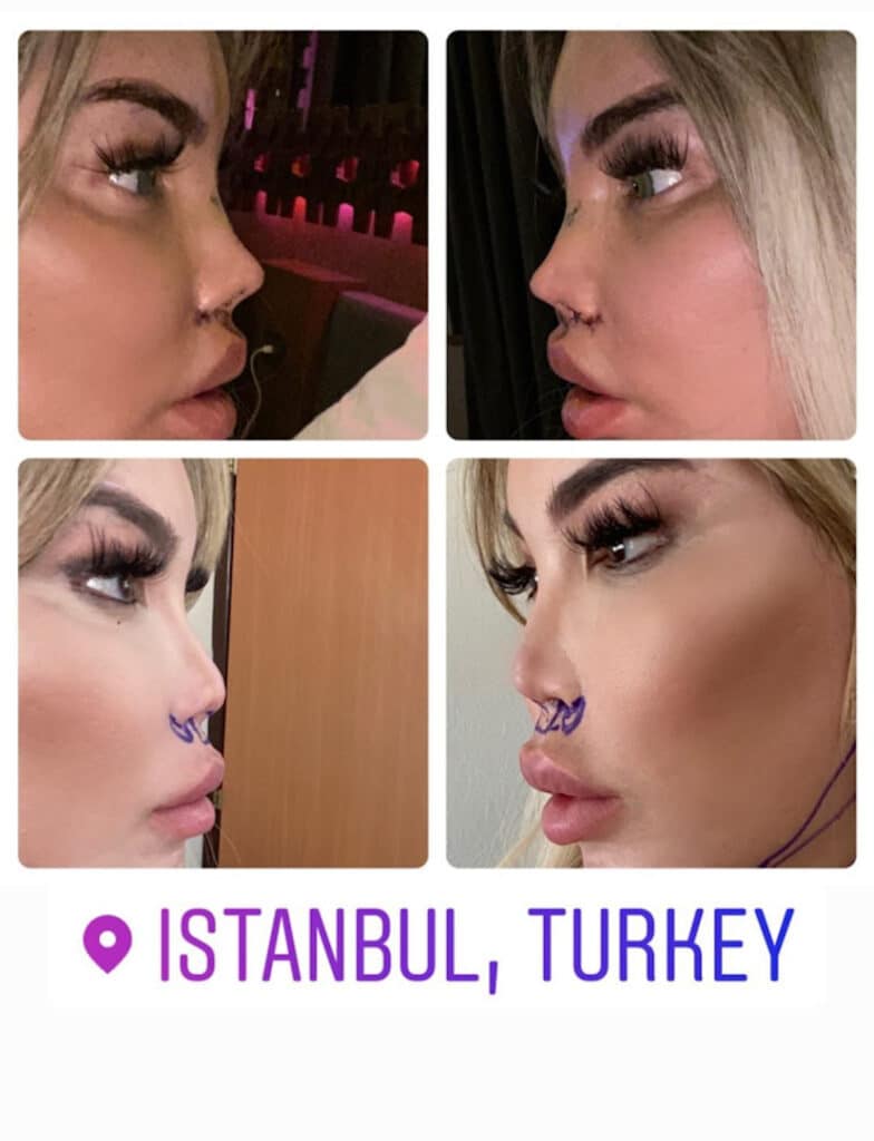 Jessica Alves oggi: com'è diventata a 2 anni dall'inizio della transizione