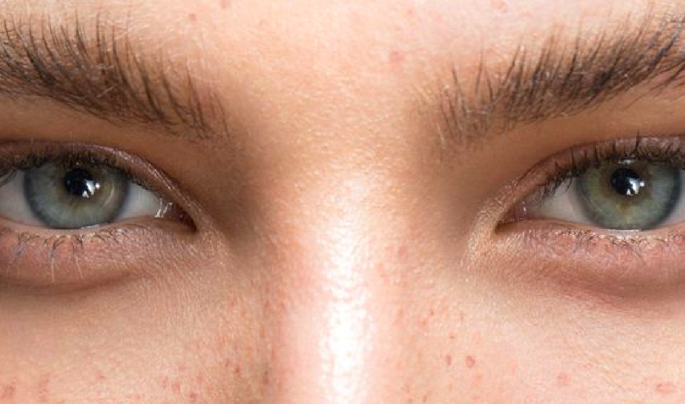 Forfora sopracciglia: rimedi e cause