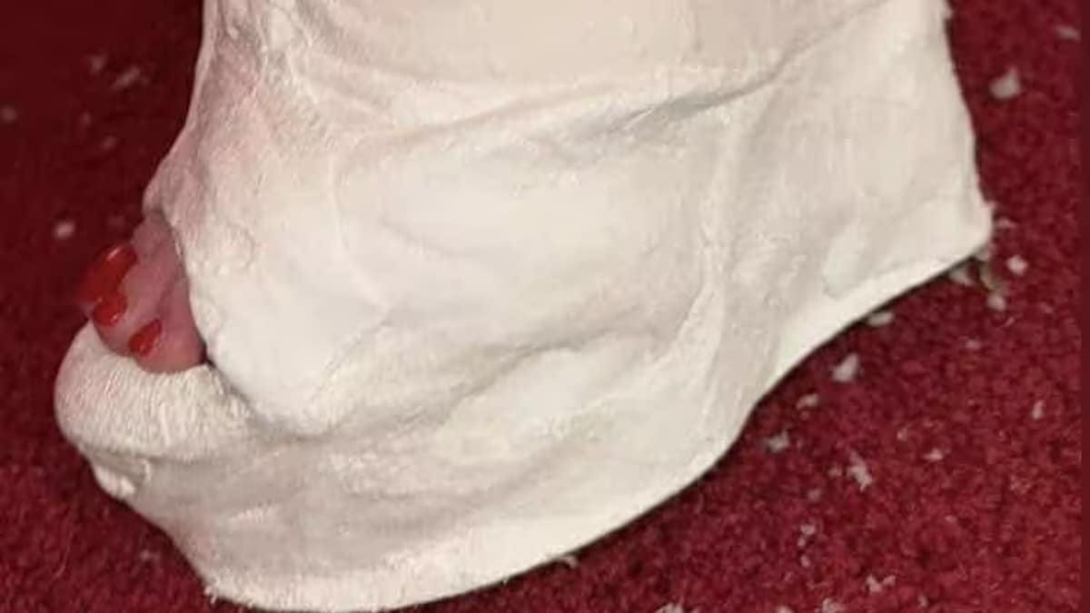 Kim Kardashian, piede rotto ma con stile: il gesso ha il tacco