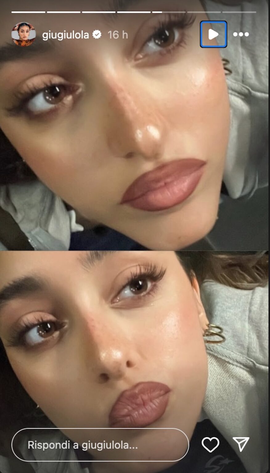 Giulia Stabile si è rifatta? Il sospetto ritocchini dopo le ultime foto